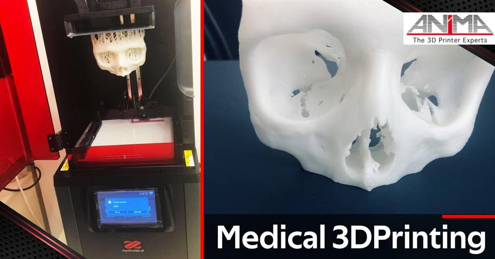 ANiMA - The 3D Printer Experts | MEDICAL 3D PRINTING